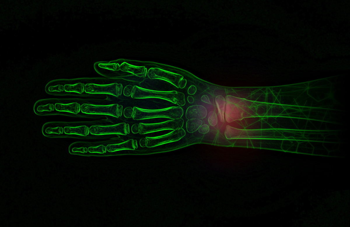 CrossFit : top 3 des blessures en overhead - Nxt Generation PHYSIO